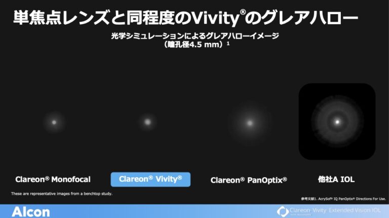 焦点拡張型多焦点眼内レンズ Vivity ビビティ（日本アルコン社） | 神戸市東灘区・住吉の松原眼科クリニック｜白内障手術、多焦点眼内レンズ ...